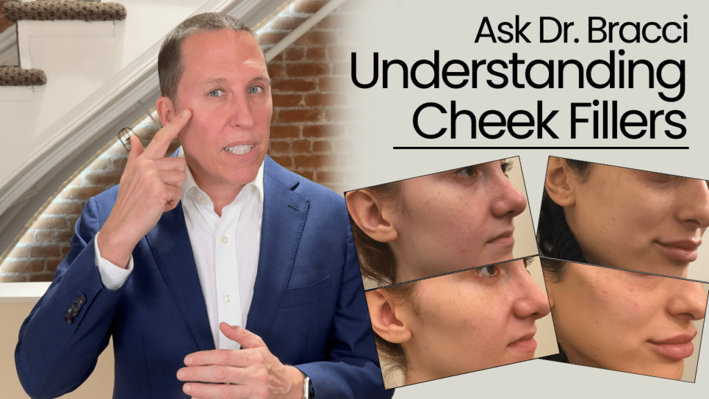 Cheek Filler Injections: Everything You Need To Know - Ask Dr. Bracci