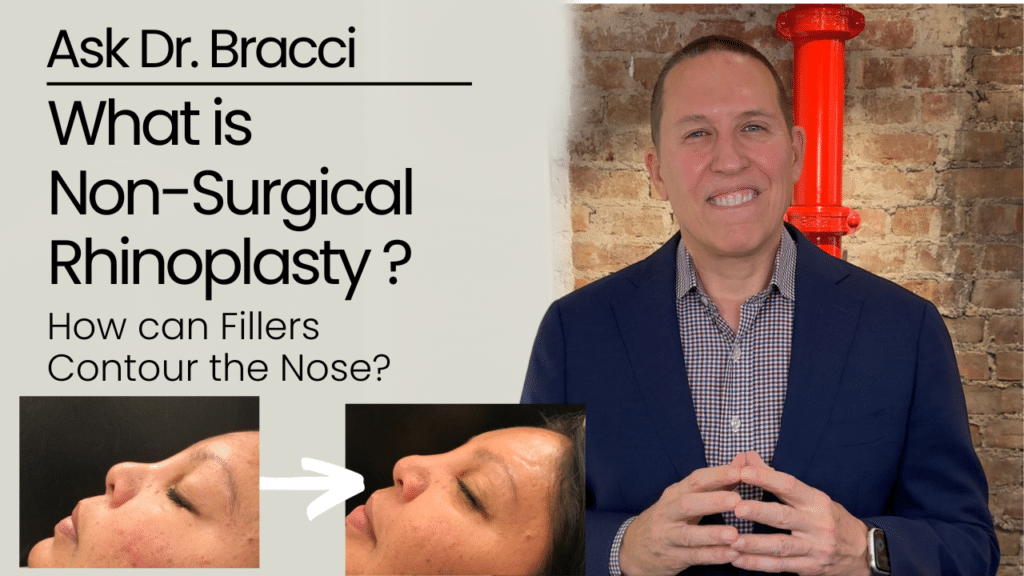 What Is Non-Surgical Rhinoplasty And How Can Fillers Contour The Nose ...