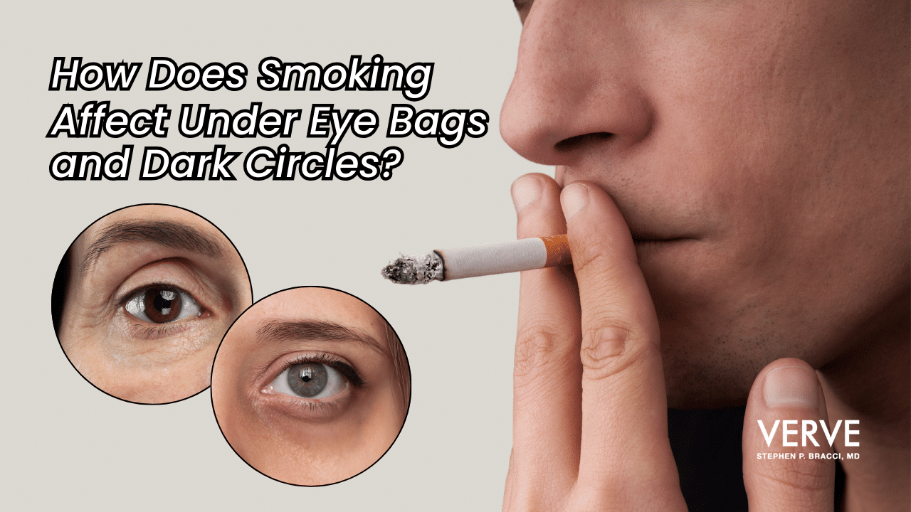 How Does Smoking Affect Under Eye Bags And Dark Circles? - Ask Dr. Bracci