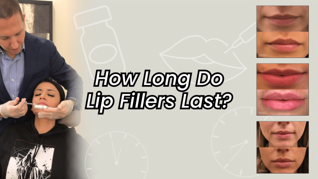 How Long Do Lip Fillers Last? - Verve Medical Cosmetics | Stephen ...