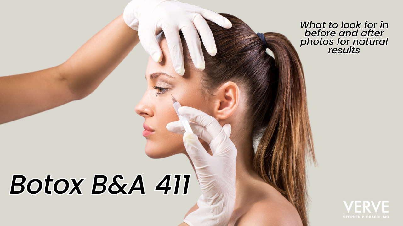 6 Thing To Look For In Botox Before And After Pictures: Cosmetic ...