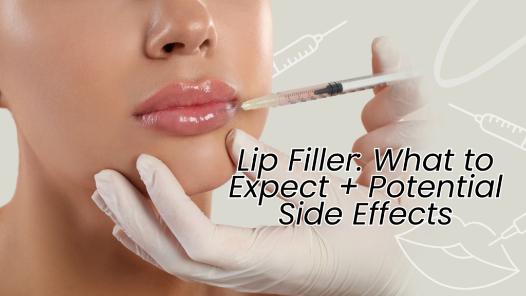Lip Filler: What To Expect + Potential Side Effects | Dermal Filler For ...