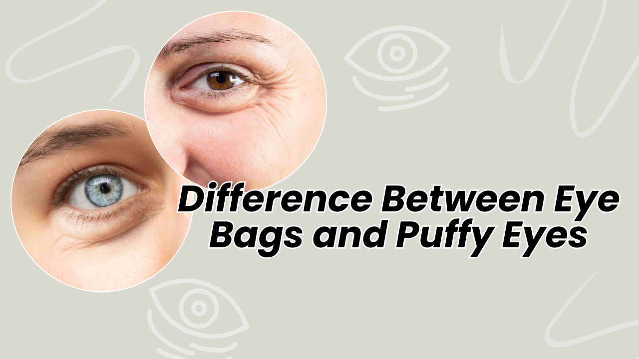 Difference Between Eye Bags And Puffy Eyes | Treating Eye Bags And ...