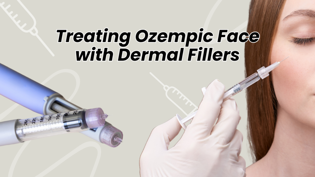 Treating Ozempic Face Sagging Skin With Dermal Fillers | Restoring Lost ...