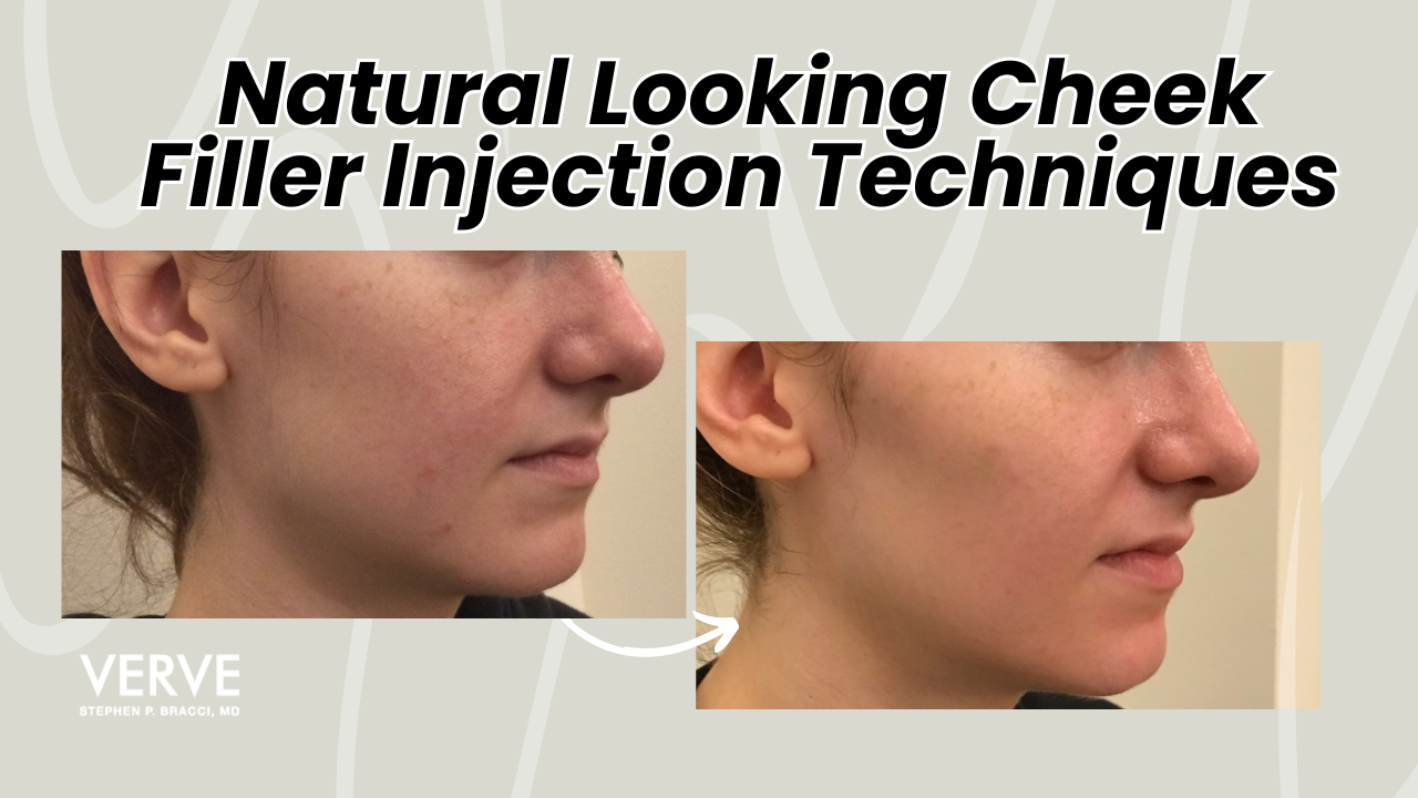 Natural-Looking Cheek Filler Injection Techniques For Older Adults ...