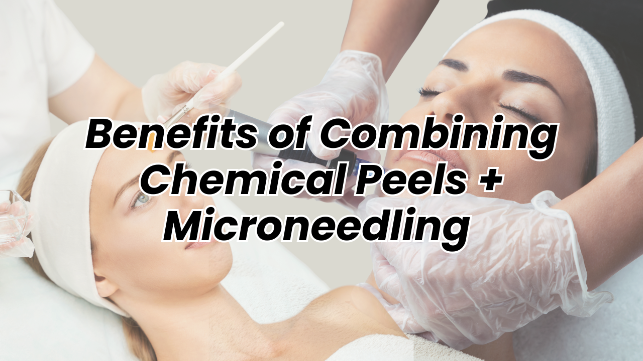 Surprising Benefits Of Combining Microneedling With Chemical Peels - Blog