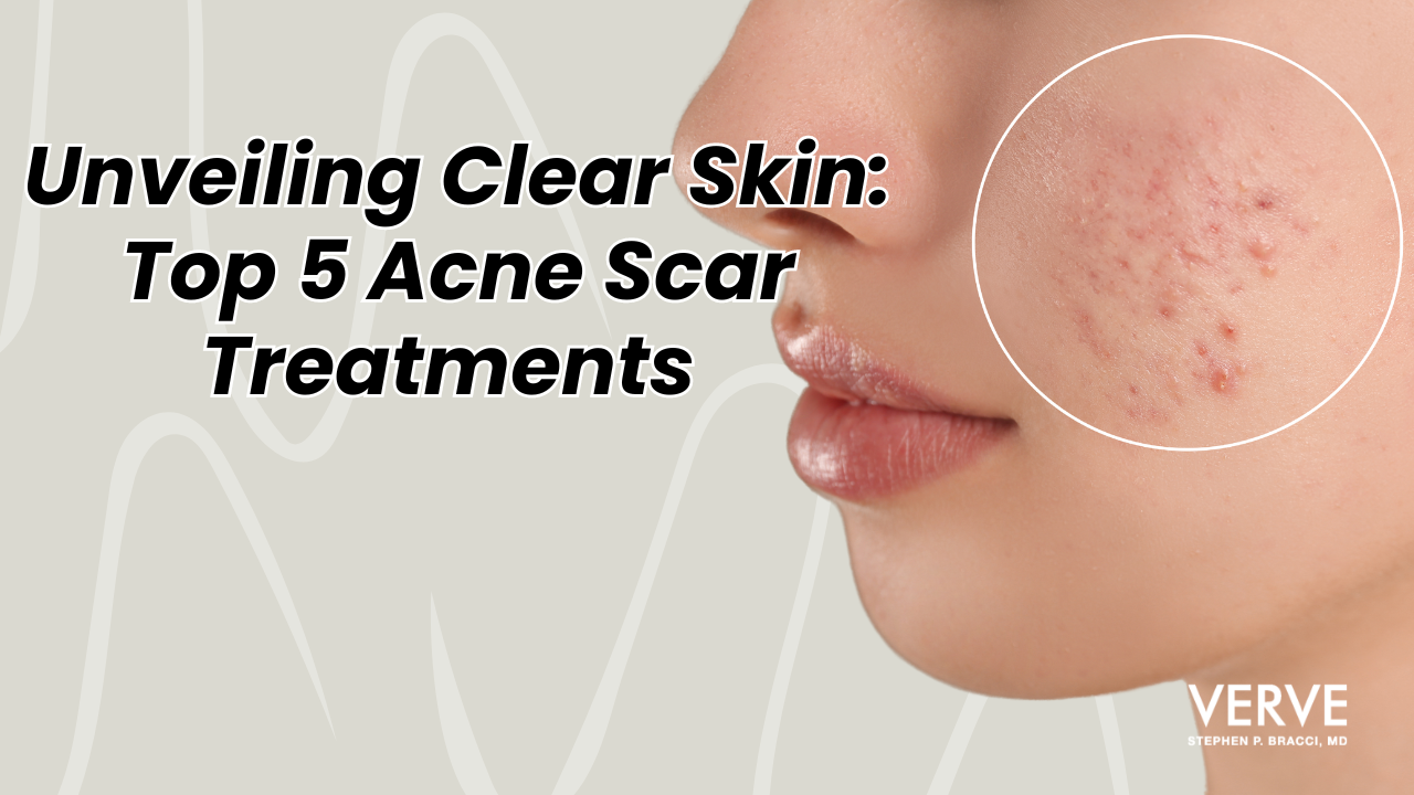 Unveiling Clear Skin: Top 5 Best Acne Scar Treatments | What Is The ...