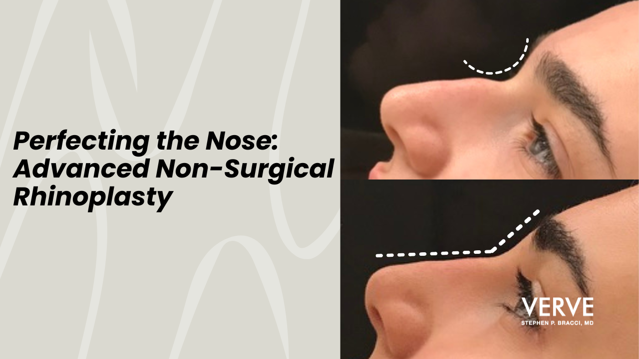 Perfecting The Nose: Advanced Non-Surgical Rhinoplasty Filler ...