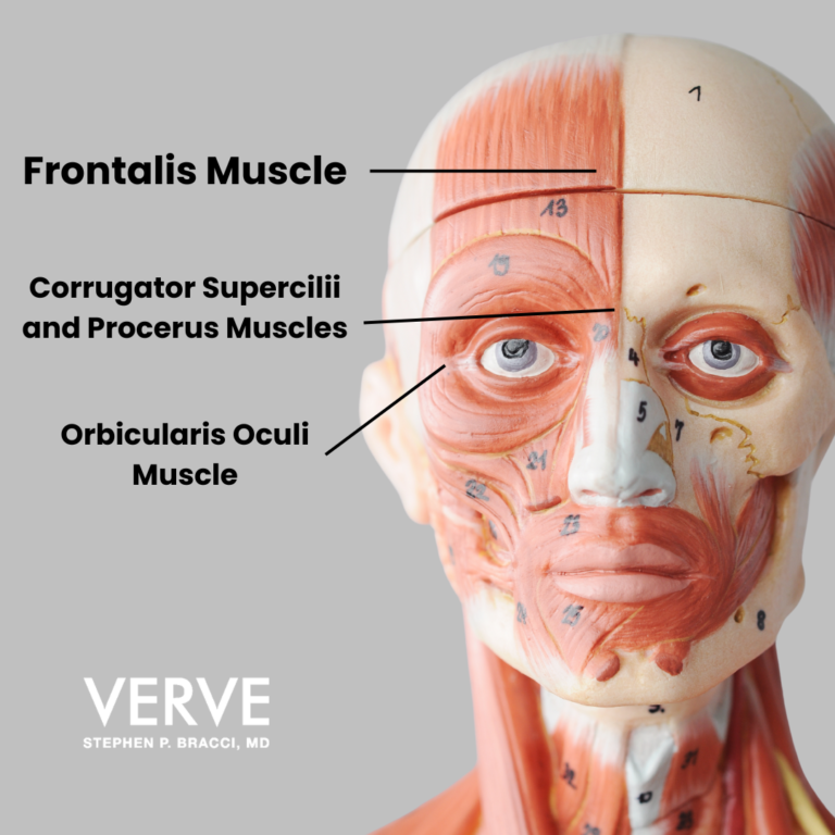 What is a Botox Brow Lift? - Verve Medical Cosmetics | Stephen Bracci, MD